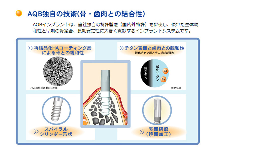 AQBインプラントシステム | 佐藤歯材 | 歯科器材、歯科材料、歯科薬品、院内感染対策の佐藤歯材