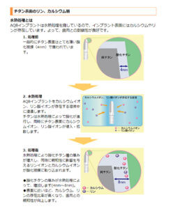 AQBインプラントシステム | 佐藤歯材 | 歯科器材、歯科材料、歯科薬品、院内感染対策の佐藤歯材